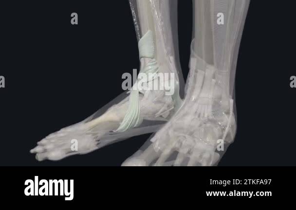 The flexor retinaculum at the ankle is formed by reinforcement of the ...