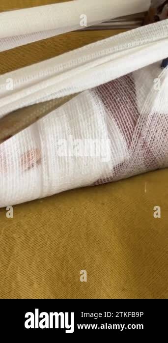 leg injury wounds needles stuck into the bone real people close-up ...