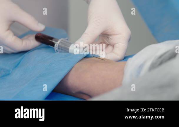 Laboratory worker doctor takes a blood sample for analysis, hand ...
