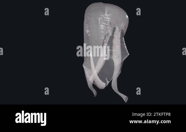 Parietal abdominal fascia (endoabdominal fascia) may be the fascia that ...