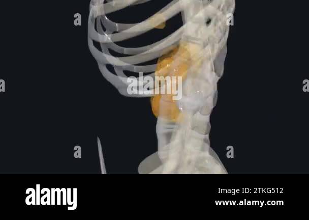 The perirenal fat capsule is a transparent capsule that prevents ...