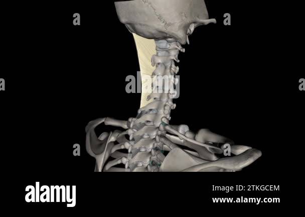 The nuchal ligament is a ligament at the back of the neck that is ...