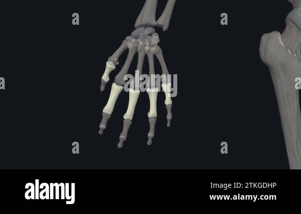 The proximal phalanx of the fingers is the proximal, or first bone, in ...