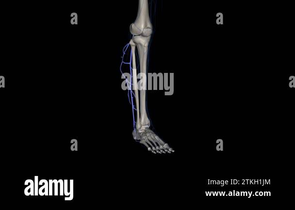 The Small Saphenous Vein (SSV) is a superficial vein of the posterior ...