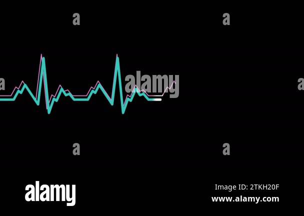 Heartbeat monitor EKG line monitor shows heartthrob, Seamlessly loop ...