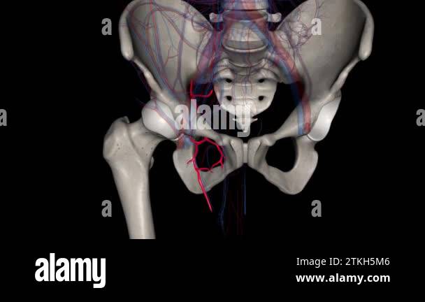 The obturator artery is a branch of the anterior division of the ...