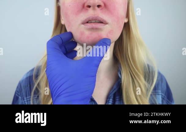 Couperosis Stock Videos & Footage - HD and 4K Video Clips - Alamy