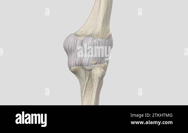 A joint capsule, also knows as an articular capsule, is a fluid-filled ...