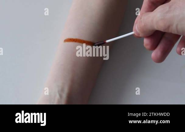 Skin swab test Stock Videos & Footage - HD and 4K Video Clips - Alamy