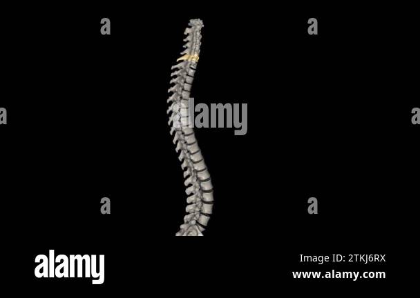 The C6 spinal vertebra is part of the cervical spinal cord, located in ...
