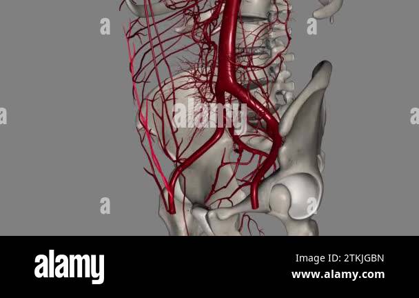 The superficial epigastric artery is a small branch of the femoral ...