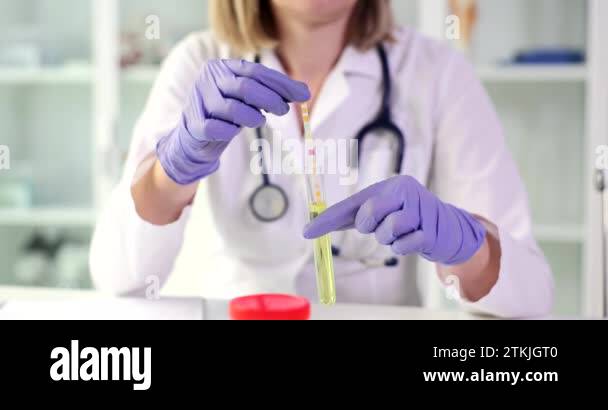 Doctor urologist lowering test strip into tube for express urine ...