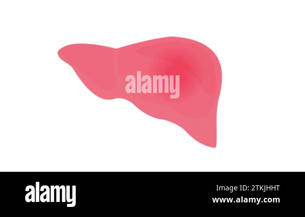 Liver pain and inflammation due to fatty liver hepatitis disease ...