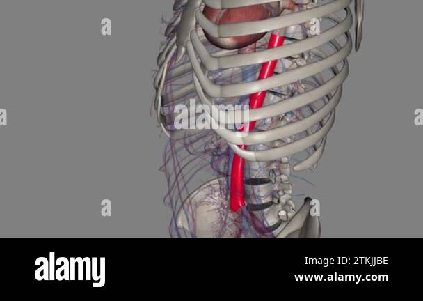 An abdominal aortic aneurysm is an enlarged area in the lower part of ...
