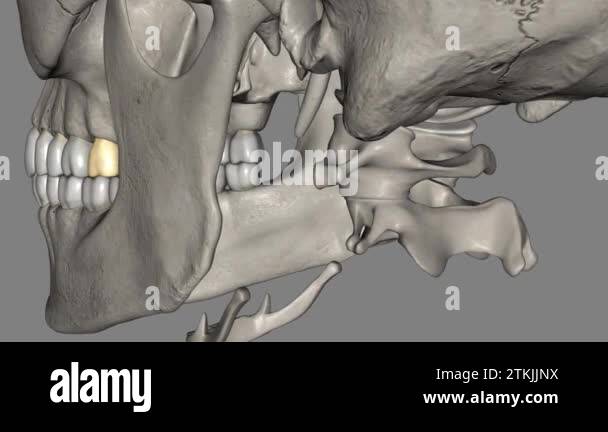 The maxillary second molar is the tooth located distally from both the ...