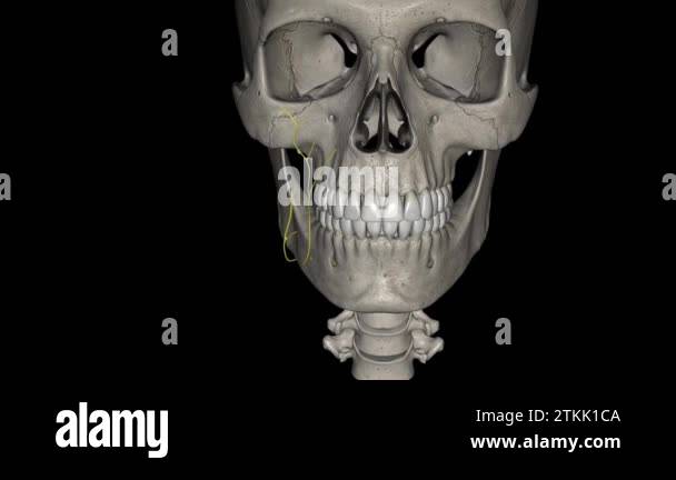Facial lymph nodes. Lymphatic drainage of the orbit and periocular ...