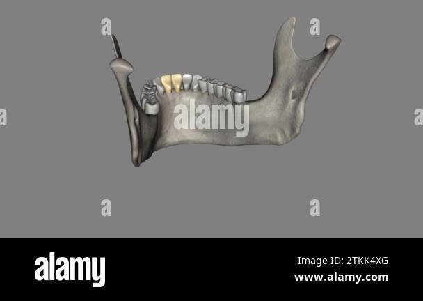 The mandibular central incisor is the tooth located on the jaw ...