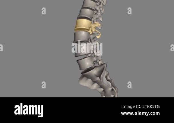 The L2 vertebra is located in the lower curvature of the spine, and the ...