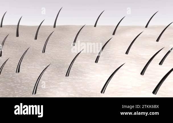 Hair loss process Stock Videos & Footage - HD and 4K Video Clips - Alamy