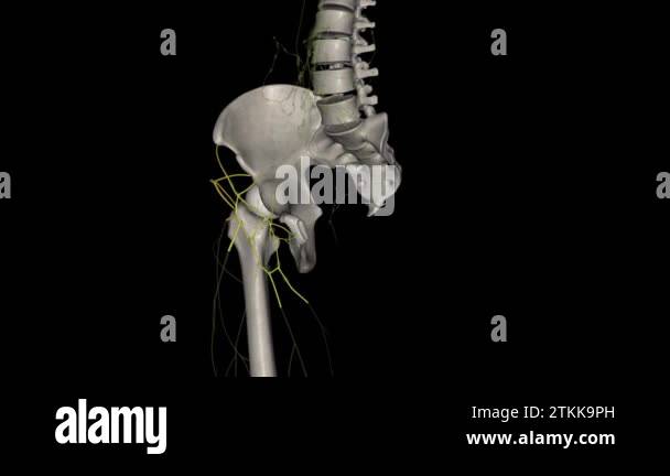 Components of the lymphatic system include lymph, lymphatic vessels and ...
