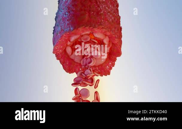 vasoconstriction and vasodilation blood pressure, dilated blood vessels ...