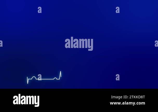 Normal ekg Stock Videos & Footage - HD and 4K Video Clips - Alamy