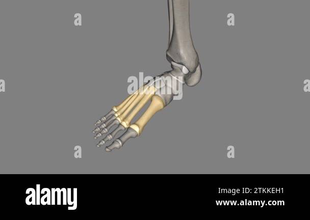The metatarsal bones are the bones of the forefoot that connect the ...