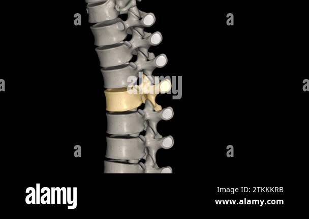 Thoracic Vertebral, T4 Twelve vertebrae are located in the thoracic ...