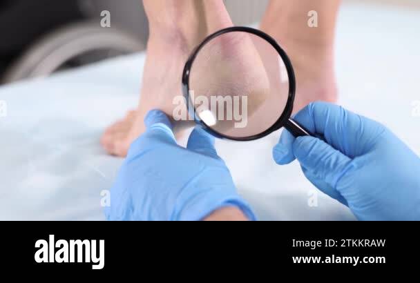 Glass feet Stock Videos & Footage - HD and 4K Video Clips - Alamy
