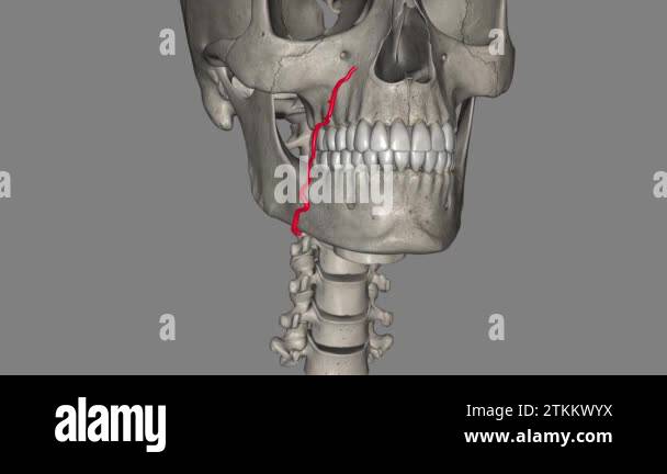 The facial artery is a branch of the external carotid artery that ...