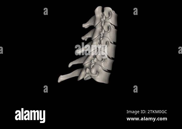 The cervical spine (neck region) consists of seven bones (C1-C7 ...