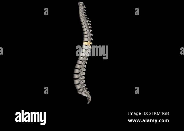Twelve vertebrae are located in the thoracic spine and are numbered T-1 ...