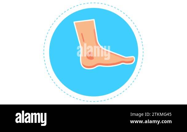 Ankle pain injury anatomy Stock Videos & Footage - HD and 4K Video ...