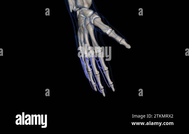 The common digital arteries are small vessels that come from the palmar ...