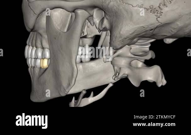 The mandibular second molar is the tooth located distally from both the ...