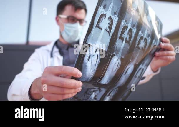 Male doctor examines x-ray of patient chest with CT scan film ...