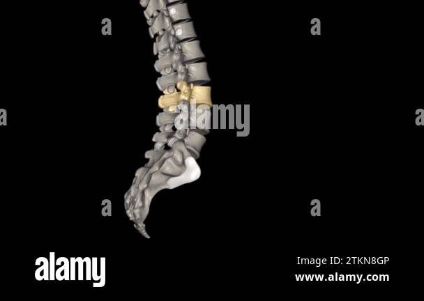 The L3 vertebra is in the middle of the five (5) lumbar vertebrae in ...
