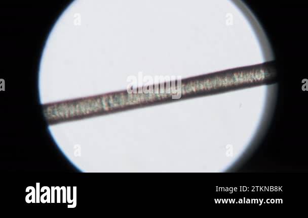 Hair follicle micrograph Stock Videos & Footage - HD and 4K Video Clips ...