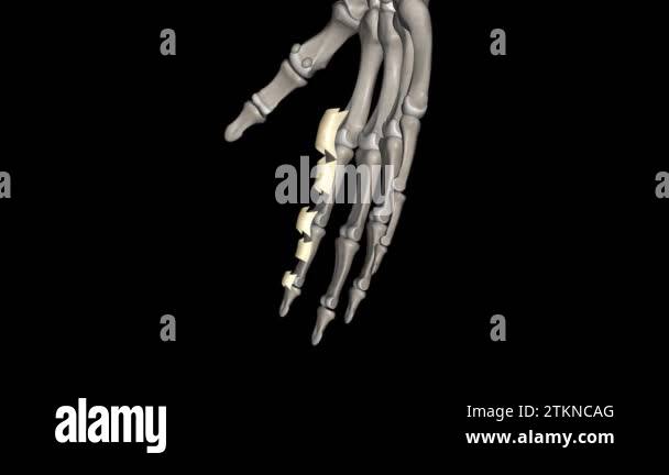 The annular ligament is a complex structure formed from the capsule ...