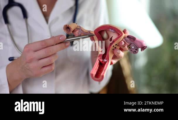 Doctor gynecologist holds anatomical model of female reproductive ...
