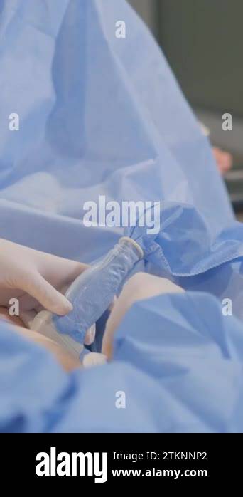 Experienced surgeons perform a complex procedure for varicose veins. A ...