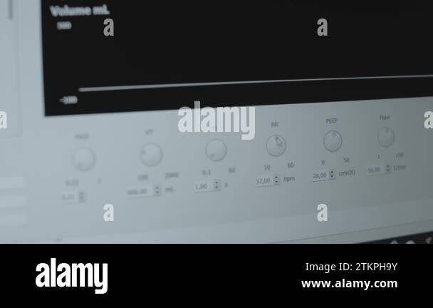 Close-up view of the screen of patient monitor displays vital signs ECG ...