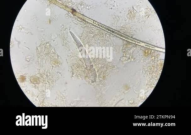 Demodex mange from a microscope view. The parasite causing a skin ...