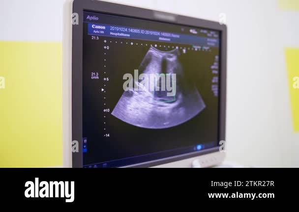Ultrasound laboratory Stock Videos & Footage - HD and 4K Video Clips ...