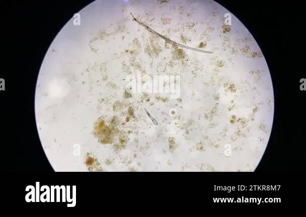 Demodex mange from a microscope view. The parasite causing a skin ...