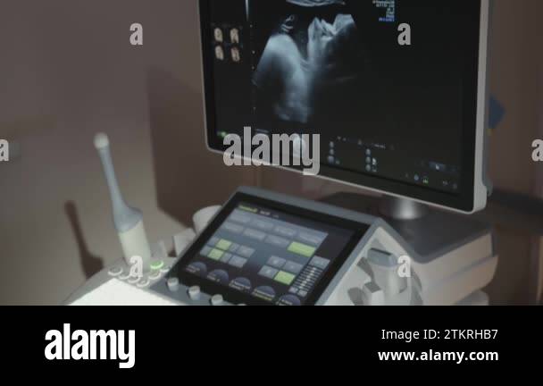 The doctors hand controls the ultrasound device. A 4D or 3D ultrasound ...