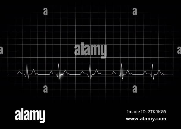 Emergency ekg monitoring. White line electrocardiogram heartbeat on a ...