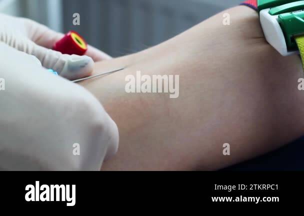 the Injection Syringe Into a Vein. Blood Sampling. Blood Tests in the ...