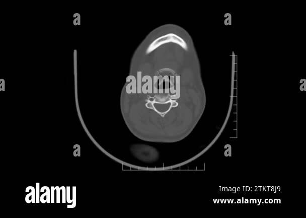 Swelling scan Stock Videos & Footage - HD and 4K Video Clips - Alamy