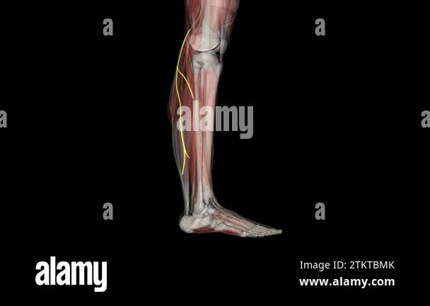 The lateral sural cutaneous nerve of the lumbosacral plexus supplies ...